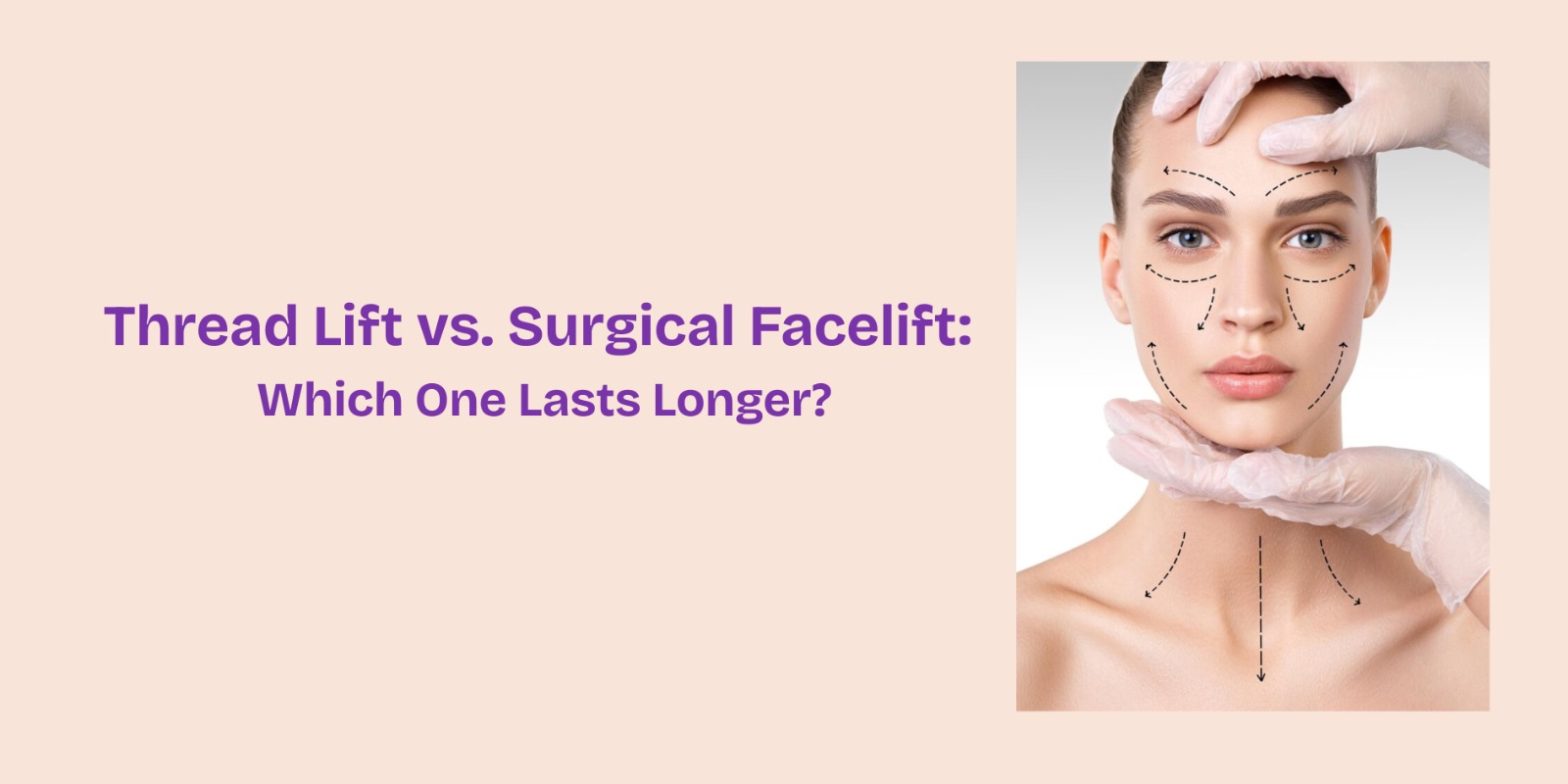 Thread Lift vs Surgical Facelift | Which Lasts Longer?